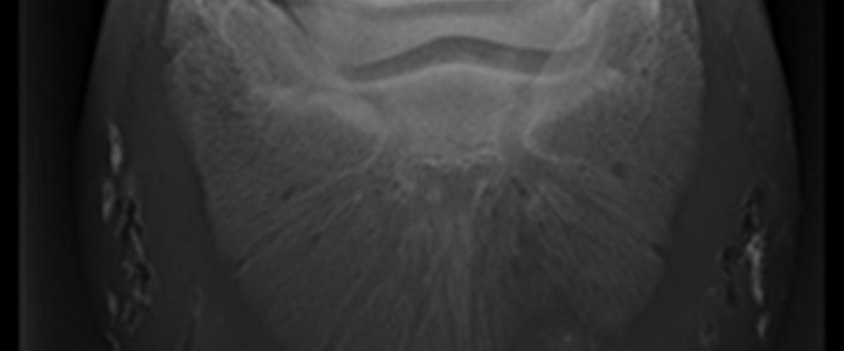 Silvas hov operation (keratom) - Diverse hest - Uploadet af TeamTT